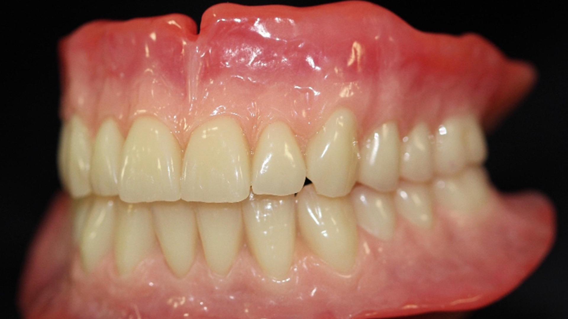 Zahnprothesen - Zahnarztzentrum Diez | Zahnarzt Diez